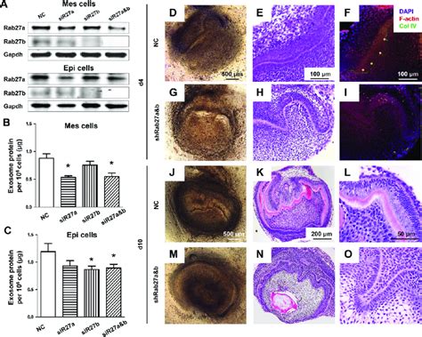 Attenuated Exosome Secretion Evokes Epithelium−mesenchyme Download