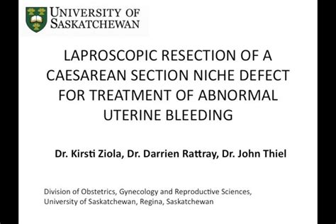 Laparoscopic Resection Of A Caesarean Section Niche Defect