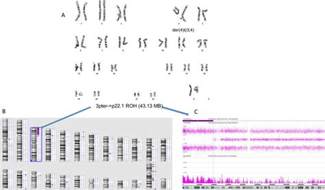Novel Correction Of A Derivative 4 In Case 6 A Karyotype Of The Mosaic