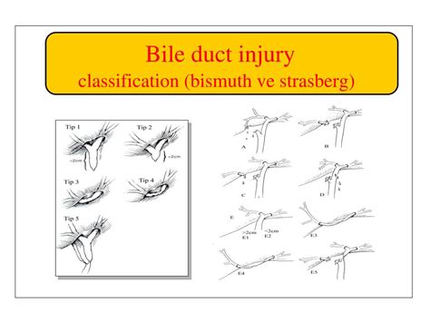 Ppt Yemeni Turkish Surgical Congress 30 31 May 2012 Sanaa