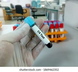 65 Complement Disorders Royalty Free Images Stock Photos Pictures