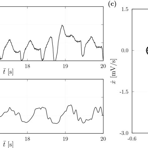 Ventricular Flutter A Real ECG Signal 34 B Simulated Time Series C Download Scientific