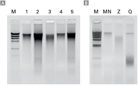 Nucleospin Dna Insect