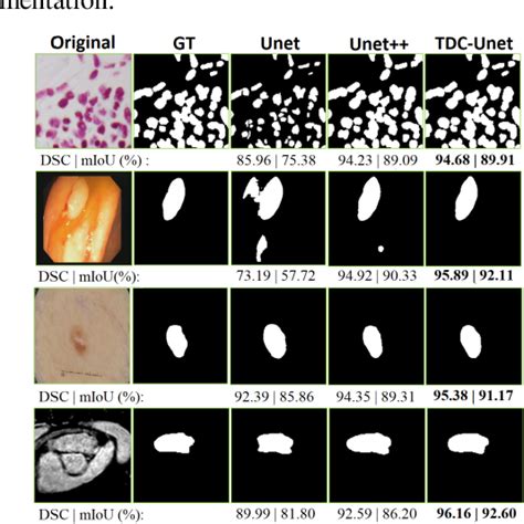 figure 4 from tdc unet triple unet with dilated convolution for