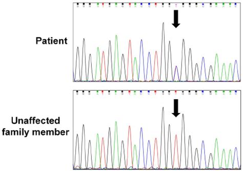 Validation Of Mutation By Sanger Sequencing Download Scientific Diagram
