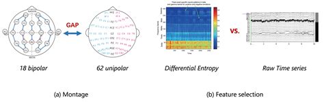 Learning Topology Agnostic Eeg Representations With Geometry Aware Modeling