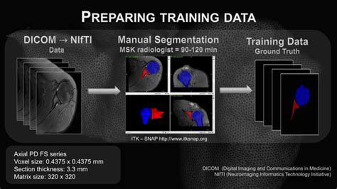 Fully Automated Mri Bone Segmentation Of Glenoid And Humeral Head Using Deep Convolutional
