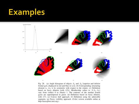 Isabelle Bloch Olivier Colliot And Roberto M Cesar Jr Ieee Trans Syst Man Cybern B