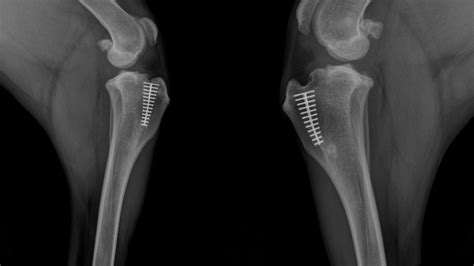 Tta 2 Tibial Tuberosity Advancement Kyon