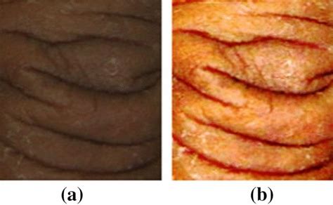 A Original Image B Pre Processed Image Download Scientific Diagram