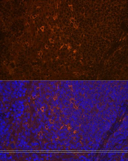 Plc Gamma 2 Plcg2 Rabbit Mab Monoclonal Antibodies Abclonal