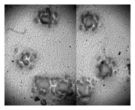 Selective Irradiation Of Gels Through Application Of Ascorbic Acid