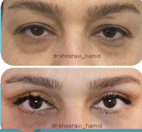 کلینیک زیبایی دکتر حمیدرضا خسروی