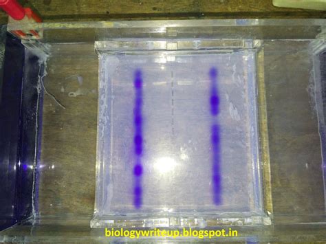 Biology Write Up Biology Articles Isolation Of Plasmid Dna Principle Different Methods Of