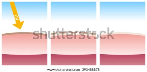 Uneven Skin Tone Uv Damage Over Royalty Free Licensable Stock Illustrations Drawings
