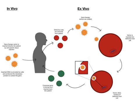 Schematic Of Gene Therapy Methods In Vivo Gene Therapy Often Involves