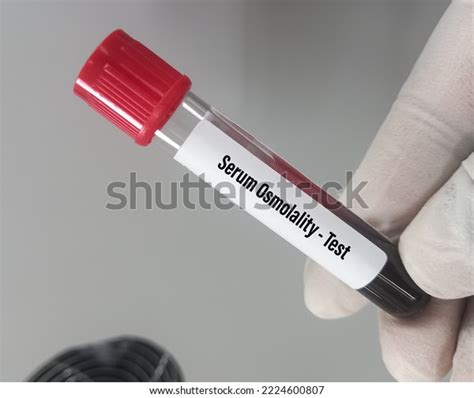 Blood Sample Serum Osmolality Test Helps Stock Photo 2224600807 Shutterstock