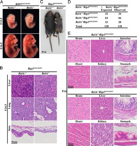 embryonic lethality and host immunity of rela deficient mice are