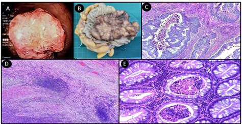 Acg 2025 Annual Meeting