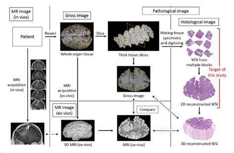 Overall Workflow Of The 3d Volume Histology Image Reconstruction Of The Download Scientific