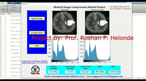 Medical Image Compression Using Matlab Source Code Image Compression