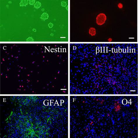 Isolation And Characterization Of Nsc Differentiation Nsc Neurospheres Download Scientific