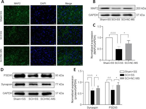 Double Target Neural Circuit Magnetic Stimulation Improves Motor