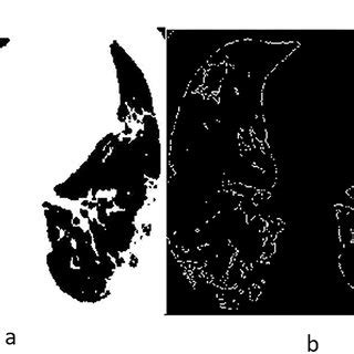 Edge Description A Processed Image B Edge Detection Image Download Scientific Diagram