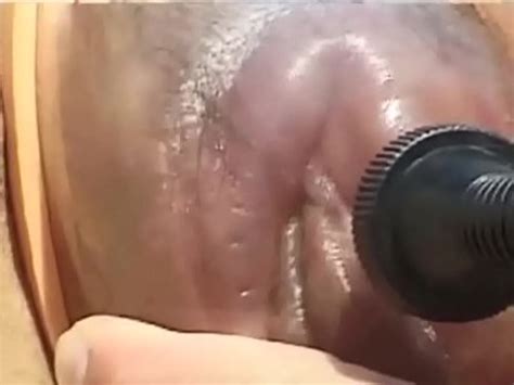 Mature Pussy Vacuum Pump XVIDEOS