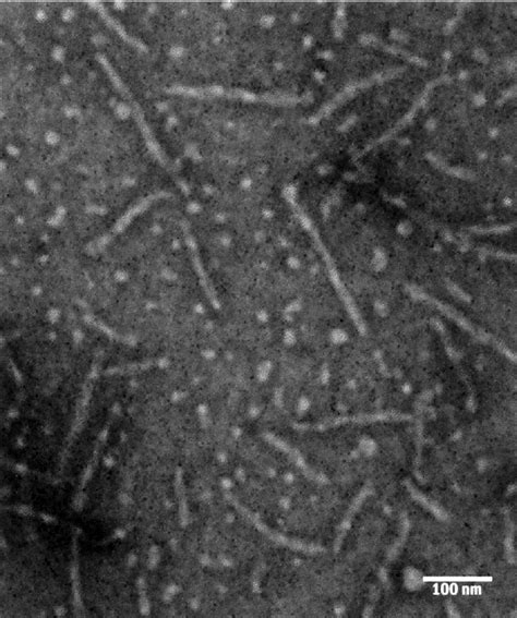 backbone asymmetric structure of casein submicelle with water from