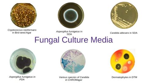 Fungal Culture Test