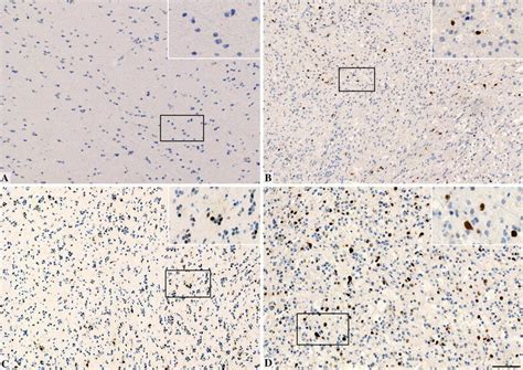 Wee1 Immunohistochemically Stained Paraffin Sections Of Normal Brain