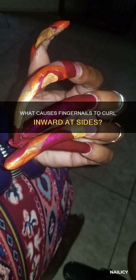 What Causes Fingernails To Curl Inward At Sides Nailicy
