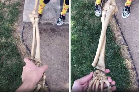 Fascinating Video Shows How Forearm Bones Twist To Make Everyday