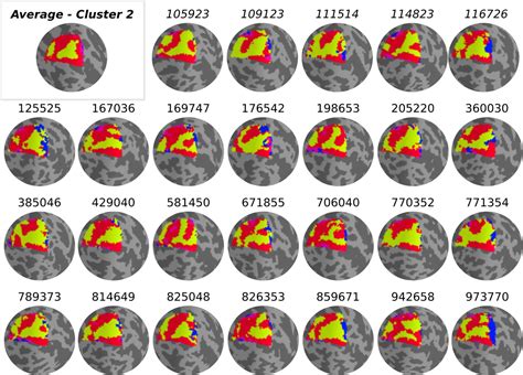 Figures And Data In Variability Of Visual Field Maps In Human Early
