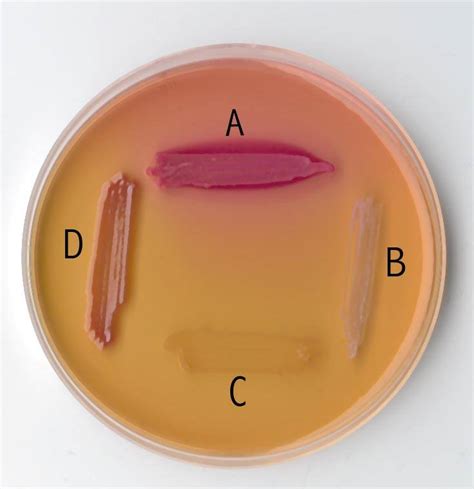 Deoxycholate Agar Doc Medical Laboratories