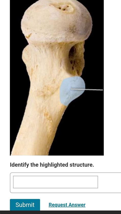 solved identify the highlighted structure submit request