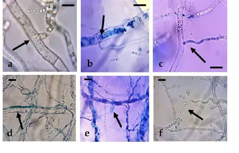 Figure 1 From Potential Of Native Trichoderma Strains As Antagonists For The Control Of Fungal