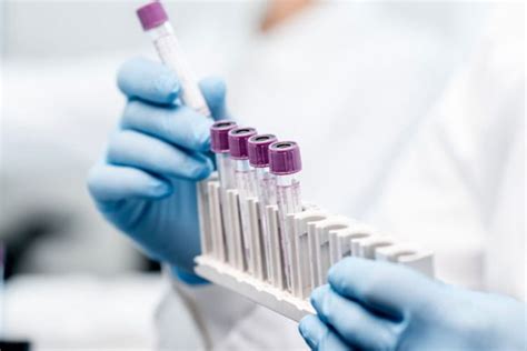 Know What Is Normal For You Lab Testing Matters