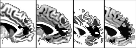 zone of spatial overlapping shown with white color of the results in