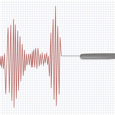 Lie Detector Test Chart