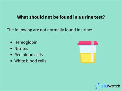 Can A Urine Test Detect Stds