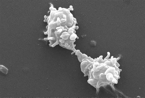 Acanthamoeba Acanthamoeba Species Morphology Life Cycle Culture