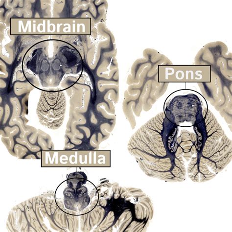 Neuroanatomy Glossary Midbrain Photos Ditki Medical And Biological