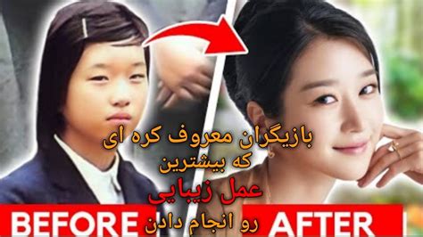 بازیگرای کره ای که با عمل زیبایی از لولو تبدیل به هلو شدن 😨 Youtube