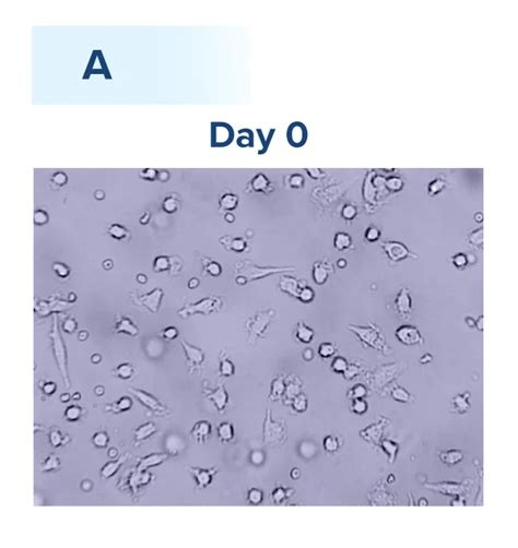 Cd14monocyte Isolation Applied Cells