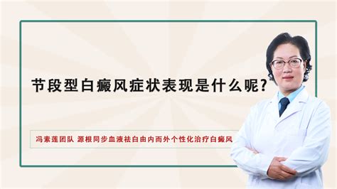 节段型白癜风的症状表现是什么呢 知乎