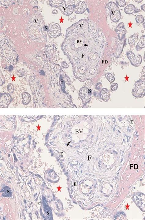 A B A Photomicrograph Of Gdm Placenta Showing Reduced Number Of Download Scientific Diagram