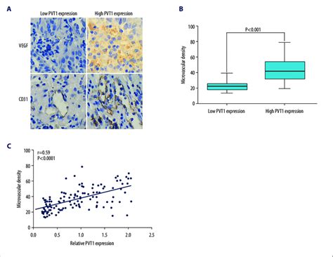 Positive Correlation Between Pvt1 And Angiogenesis In Nsclc A Download Scientific Diagram