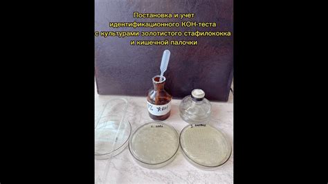 Постановка и учет КОН теста (тест Грегерсена) | Микробиология - YouTube